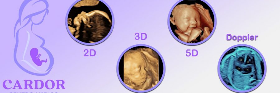 Banner – CARDOR Ecografías